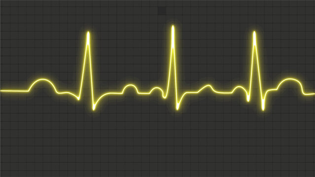 Normal Heart Rate Line