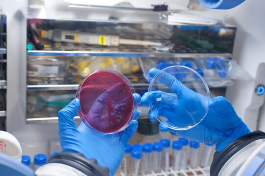 Bacterial Plate Images – Browse 4,325 Stock Photos, Vectors, and Video ...