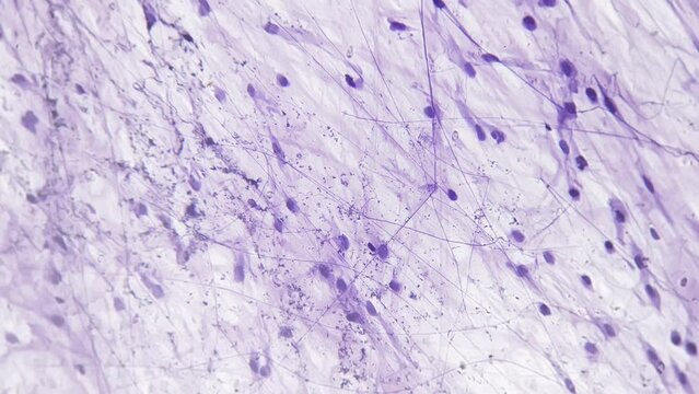 Loose Fibrous Connective Tissue