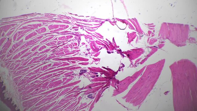 "Filiform Papilla" Images – Browse 96 Stock Photos, Vectors, and Video ...