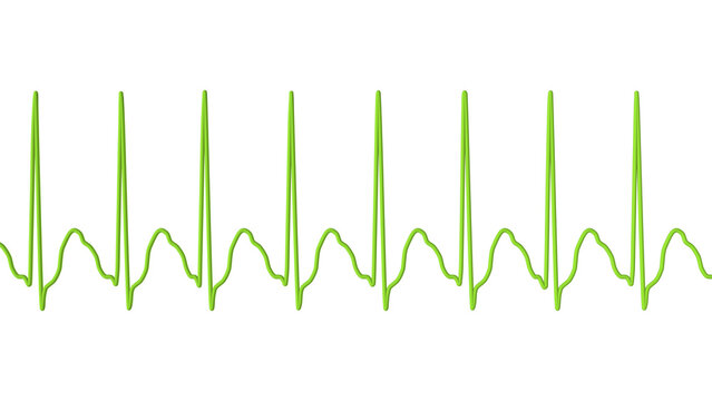 Atrial Flutter Images – Browse 632 Stock Photos, Vectors, and Video ...