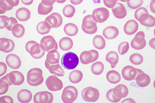 รูปภาพMicrocyte – เลือกดูภาพถ่ายสต็อก เวกเตอร์ และวิดีโอ341 | Adobe Stock