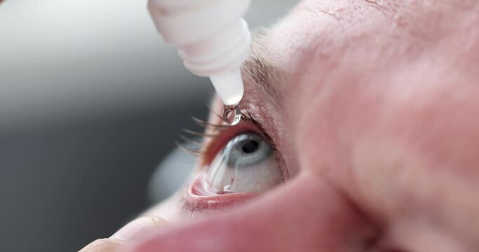 Blefarit bilder – Bläddra bland 1,184 stockfoton, vektorer och videor ...