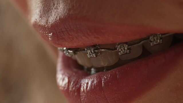 Tumblr Lip Biting With Braces