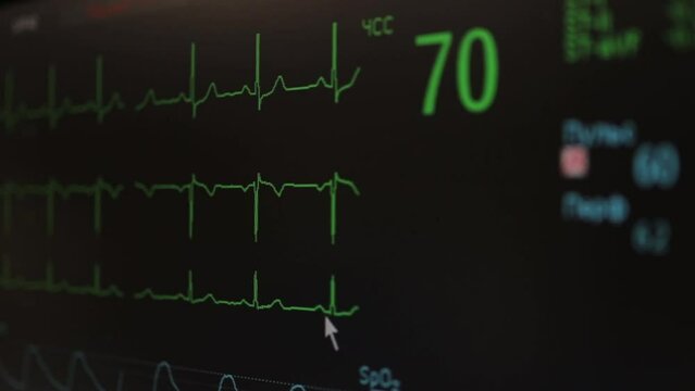 Hospital Heart Monitor Screen
