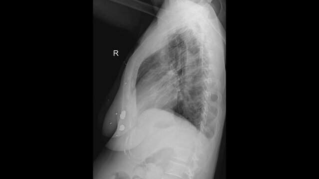 "Chest Anatomy" Images – Browse 312 Stock Photos, Vectors, and Video ...