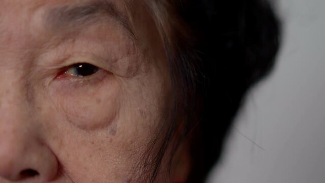 Phacoemulsification Images – Browse 510 Stock Photos, Vectors, and Video | Adobe Stock