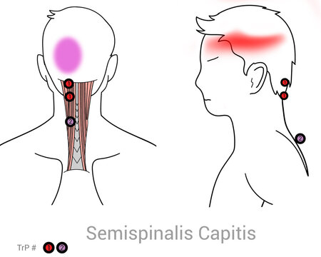 semispinalis