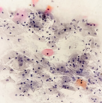 Smear Under Microscope Images – Browse 907 Stock Photos, Vectors, and ...