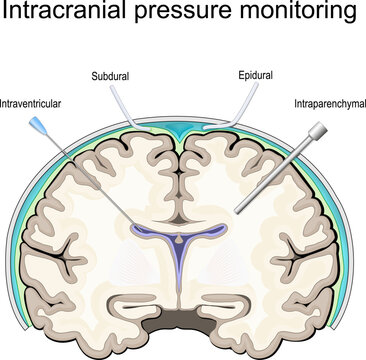 Icp Images – Browse 1,019 Stock Photos, Vectors, and Video | Adobe Stock