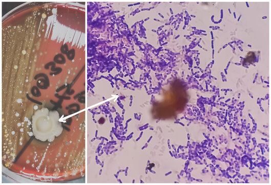 "Gram Staining" Images – Browse 810 Stock Photos, Vectors, and Video ...