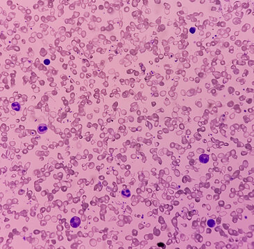 รูปภาพSpherocyte – เลือกดูภาพถ่ายสต็อก เวกเตอร์ และวิดีโอ357 | Adobe Stock