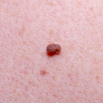 Basaliom-Bilder: Stock-Fotos & -Videos. | Adobe Stock