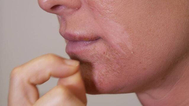 "Dry Skin" Images – Browse 26,095 Stock Photos, Vectors, and Video ...