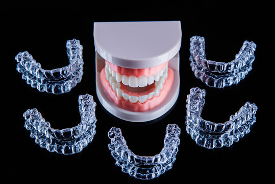 Invisalign Black Background Images – Browse 413 Stock Photos, Vectors ...