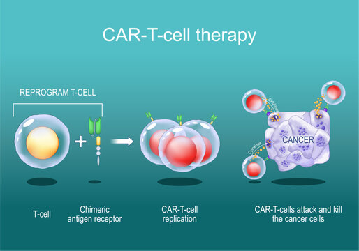 Car-T-Cell Images – Browse 4 Stock Photos, Vectors, and Video | Adobe Stock