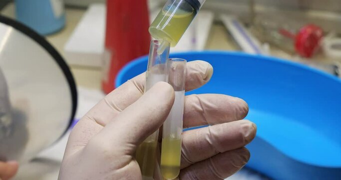 Ascites Images – Browse 800 Stock Photos, Vectors, and Video | Adobe Stock