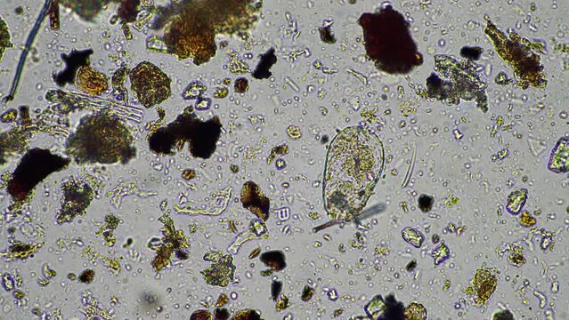 Amoeba Microscope Images – Browse 7,296 Stock Photos, Vectors, and ...