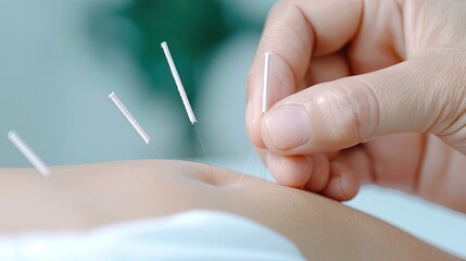 20+ Free Acupuncture Images Free | Free HD Downloads - Pikwizard