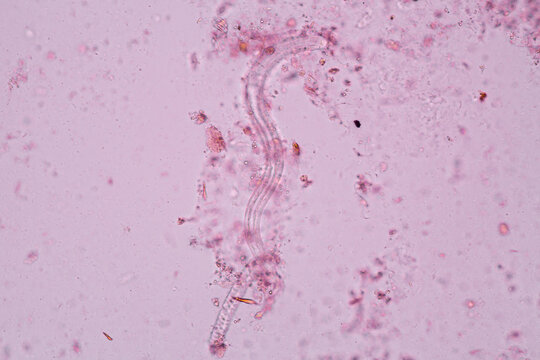 "Enterobius Vermicularis" Images – Browse 2,341 Stock Photos, Vectors ...