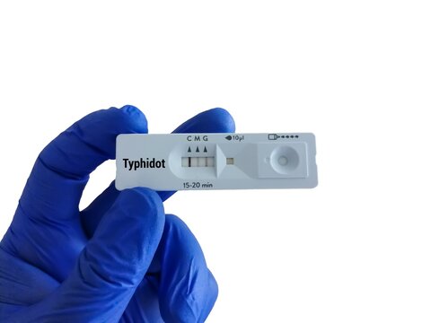 "Typhoid Fever" Images – Browse 2,581 Stock Photos, Vectors, and Video ...