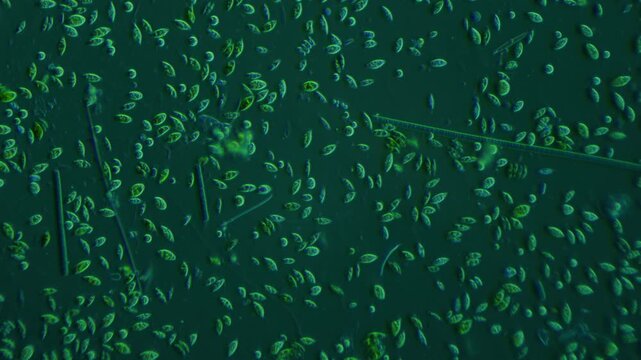 Imágenes de Cyanobacteria: descubre bancos de fotos, ilustraciones ...