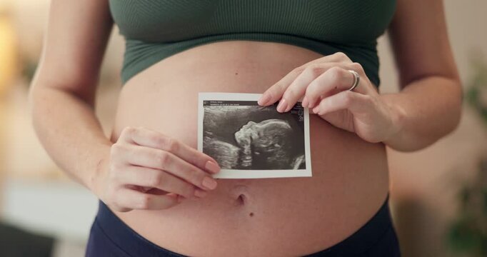 Baby Sonogram Images – Browse 12,238 Stock Photos, Vectors, and Video ...