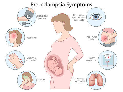 Preeclampsia Pictures