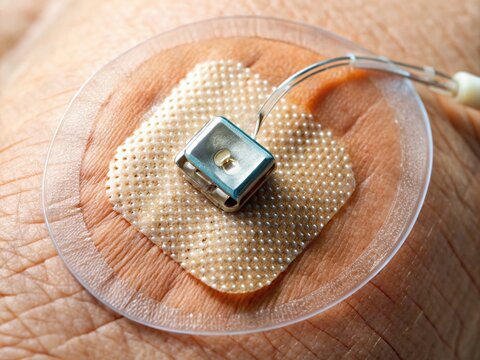 รูปภาพPort-A-Cath – เลือกดูภาพถ่ายสต็อก เวกเตอร์ และวิดีโอ121 | Adobe Stock