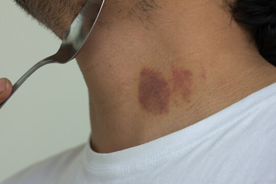 Hickey Images – Browse 281 Stock Photos, Vectors, and Video | Adobe Stock
