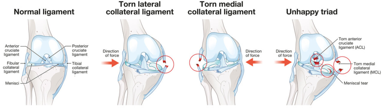 「Acl」の写真素材 | 2,849件の無料イラスト画像 | Adobe Stock