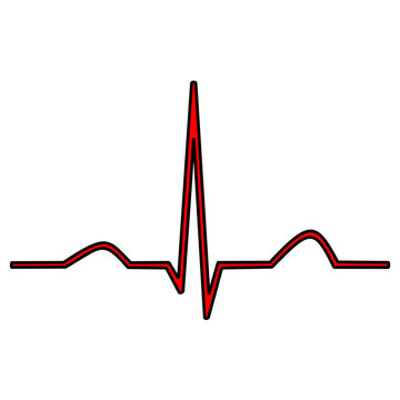 "Qrs Complex" Images – Browse 914 Stock Photos, Vectors, and Video ...